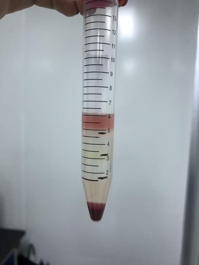 percoll分离液分层4-千图网